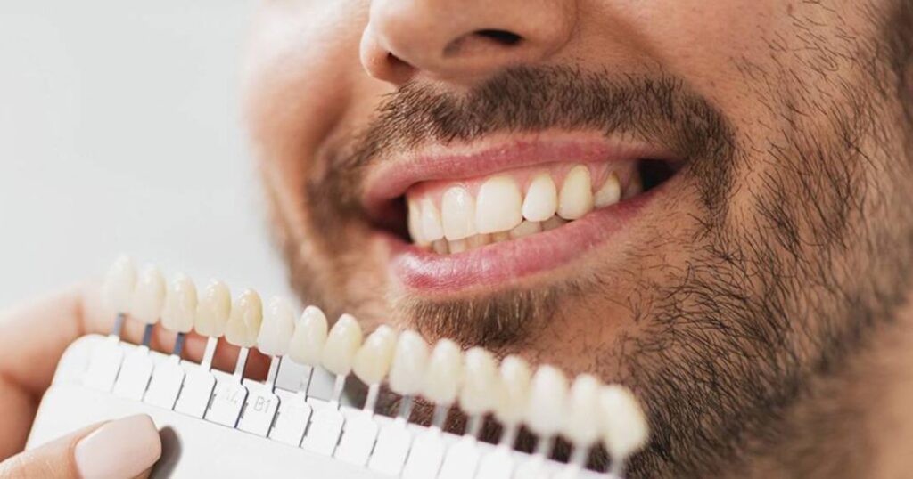 Zirconia Crown vs Emax-Choosing the Perfect Crown for Your Smile