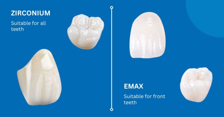 Zirconia Crown vs Emax-Choosing the Perfect Crown for Your Smile
