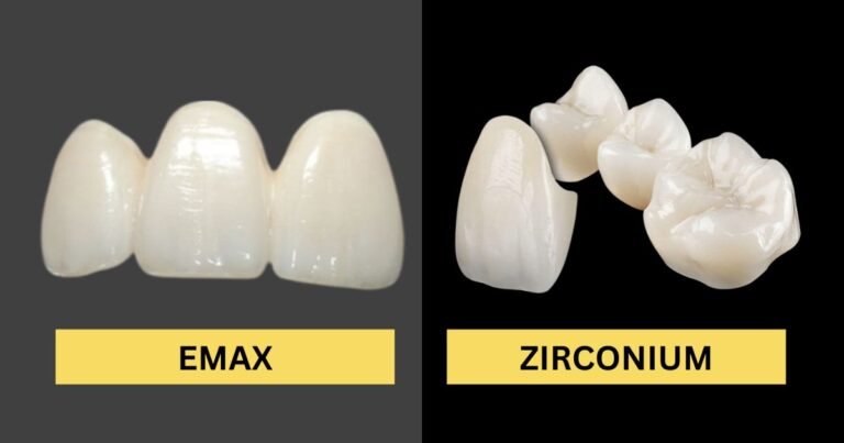 Zirconia Crown vs Emax-Choosing the Perfect Crown for Your Smile